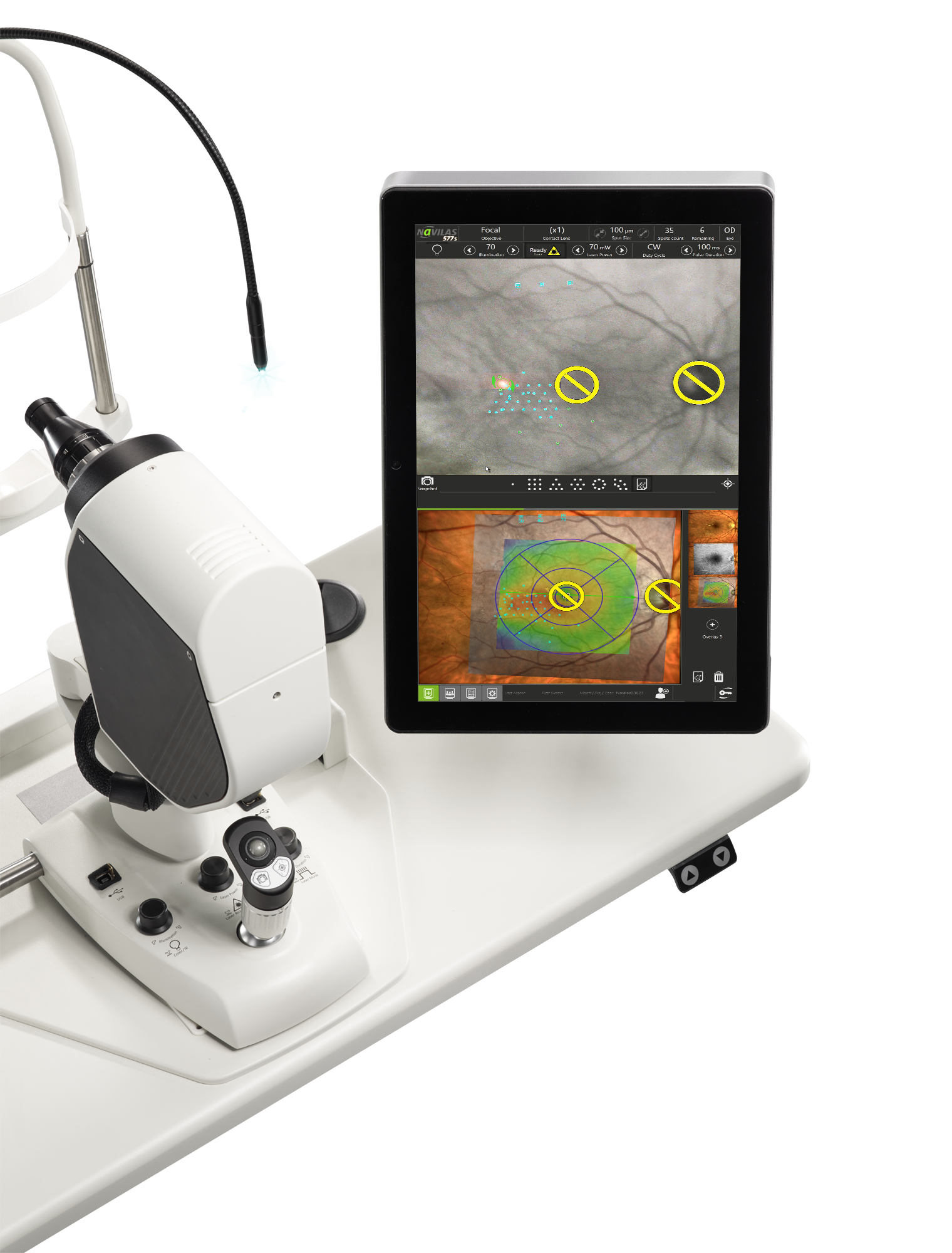 Installation Laser Navilas Sanotek - Ophtalmologie l'Union