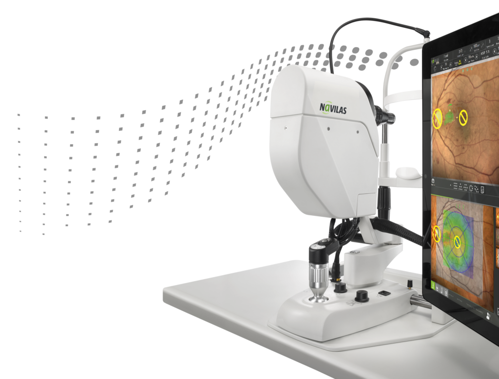 Installation Laser Navilas Sanotek - Ophtalmologie l'Union