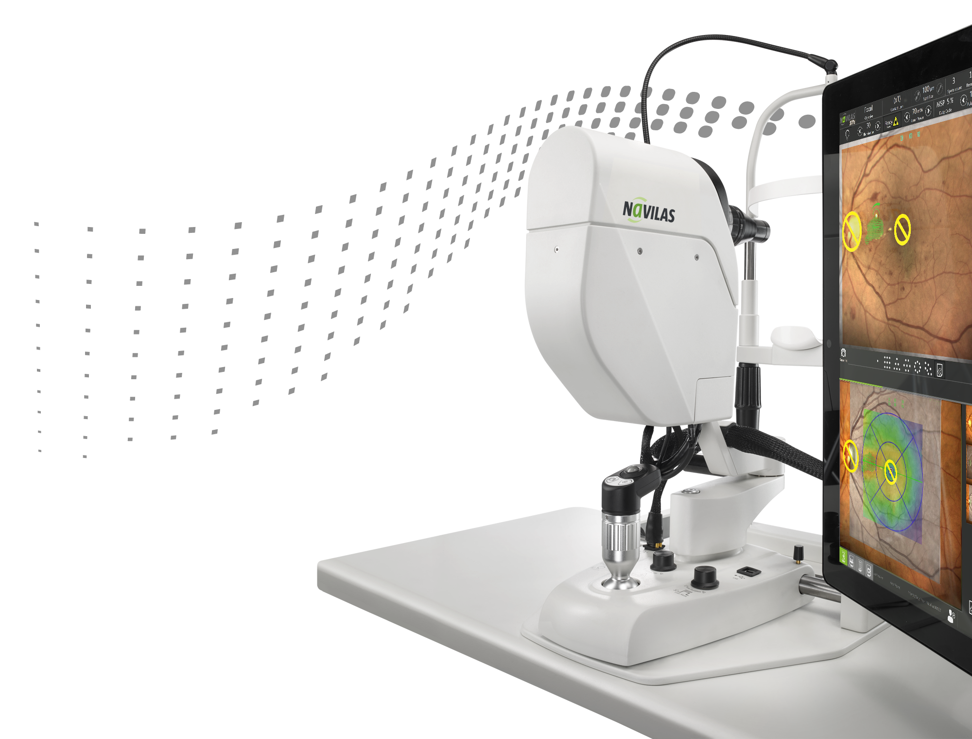 Installation Laser Navilas Sanotek - Ophtalmologie l'Union